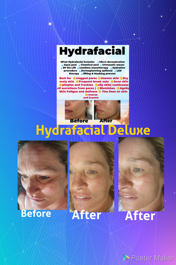 HydraFacial Models Hydrafacial Glasgow