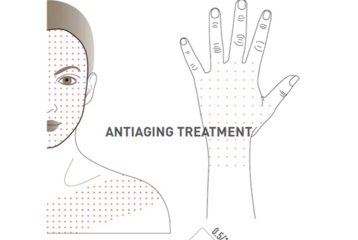 Skin Booster injections